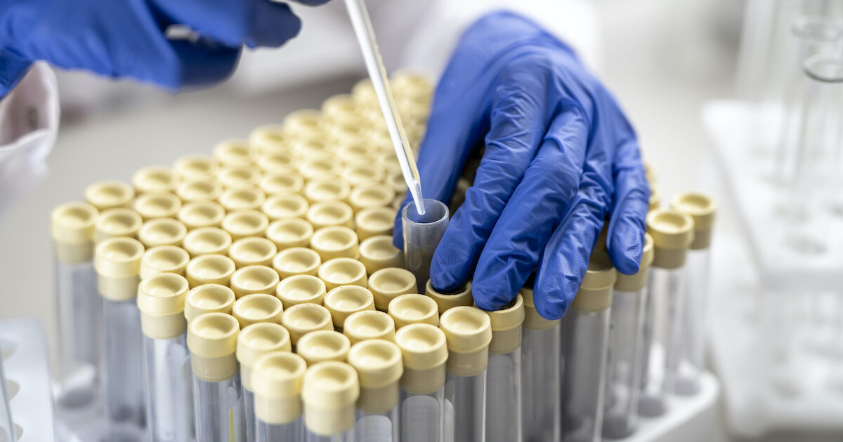 Análisis de metales pesados en agua potable y residual | Biofleming